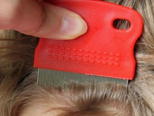 Läuse natürlich bekämpfen